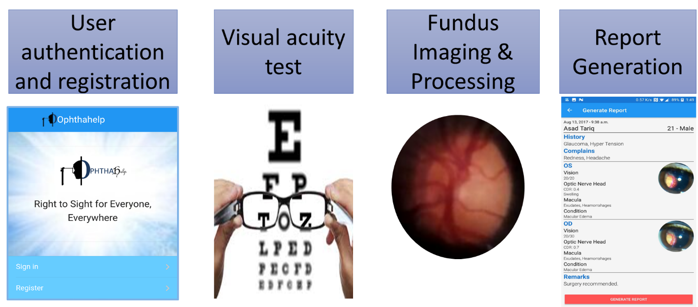 Decision Support System For Detection Of Glaucoma Using Structural And